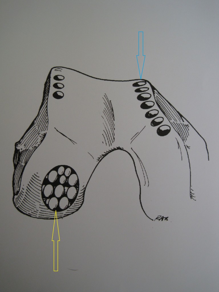 Lésion du cartilage - Clinique du sport